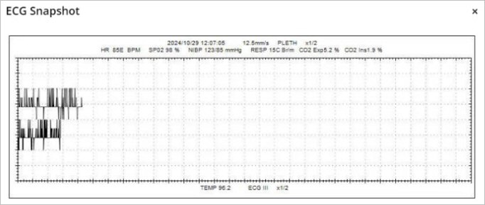 Sensei Cloud Release 0.1.13796 | 03 Nov 2024 – Carestream Dental