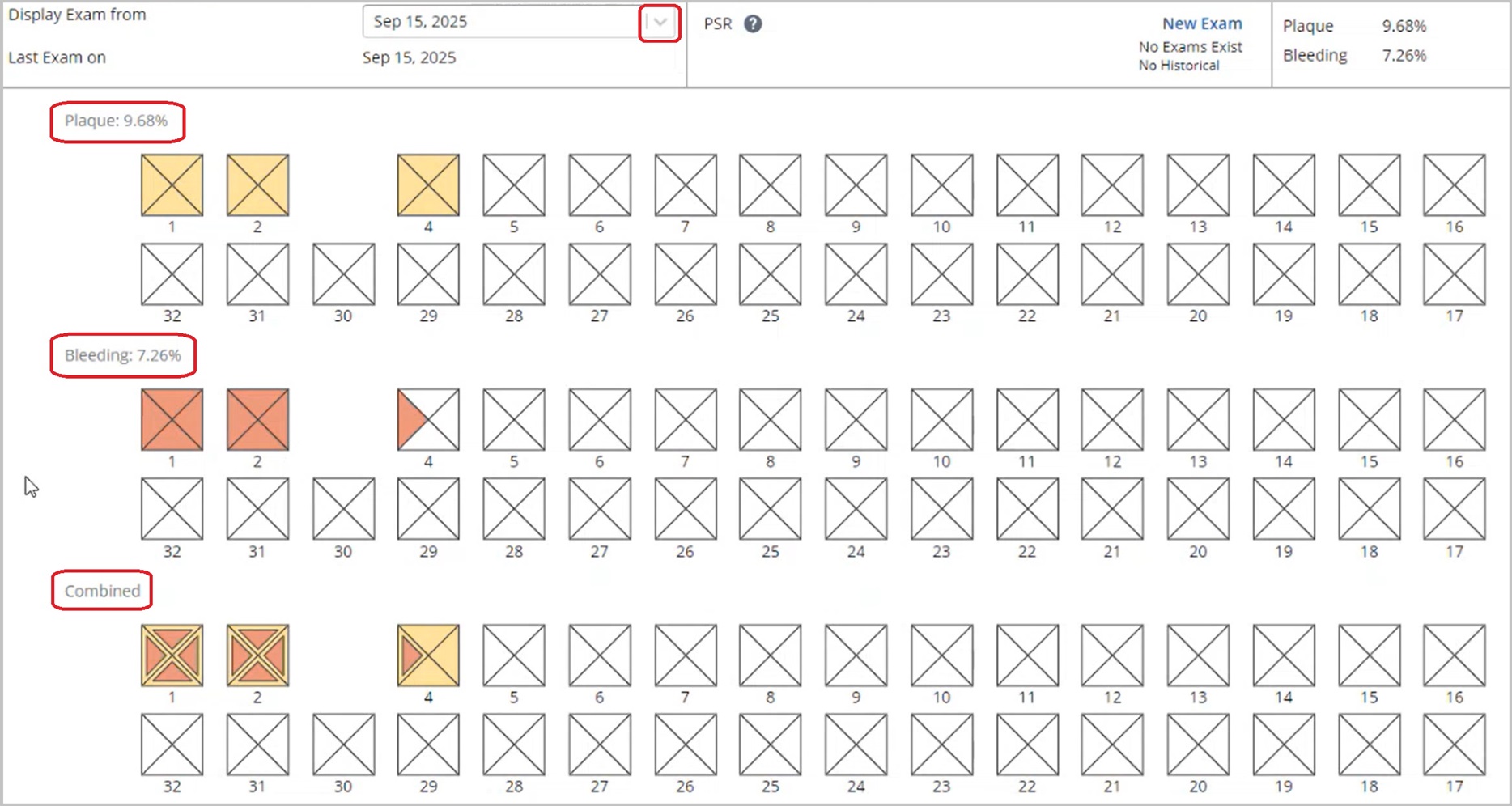 Sensei Cloud Release 0.1.17271 | 28 Sep 2025 – Carestream Dental