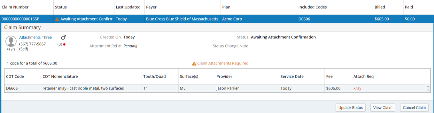 How to Add Attachments to an NEA FastAttach® Claim – Carestream Dental